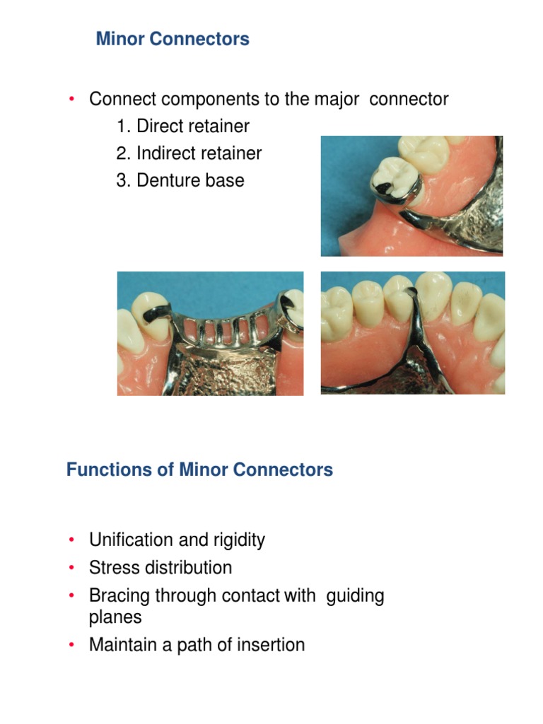 Minor Connectors: Connect Components To The Major Connector 1. Direct ...