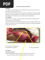 Cours-No 05 - Éventration, Éviscération | PDF | Spécialités médicales ...