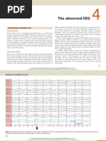 Eeg Report Formate | PDF | Electroencephalography | Epilepsy
