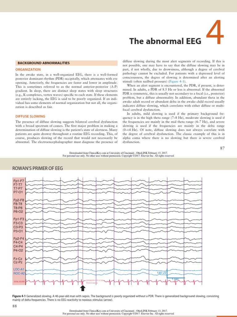 The Abnormal EEG: Background Abnormalities | PDF | Epilepsy ...