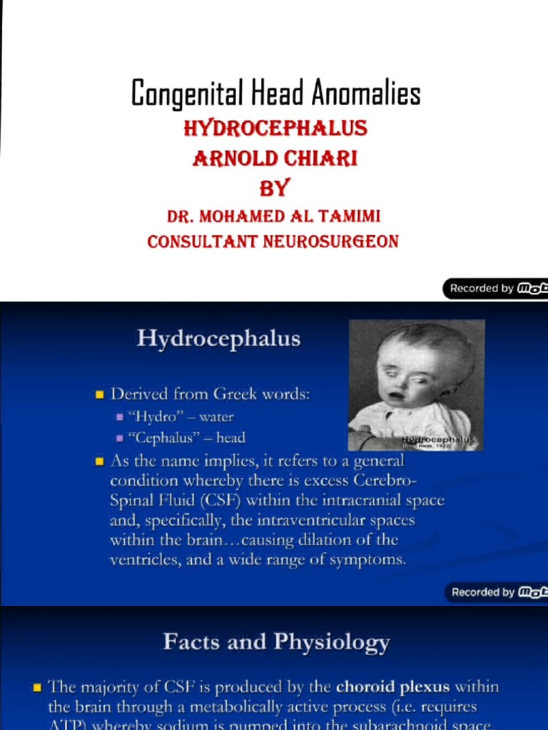 Congenital Head Anomalies Pdf
