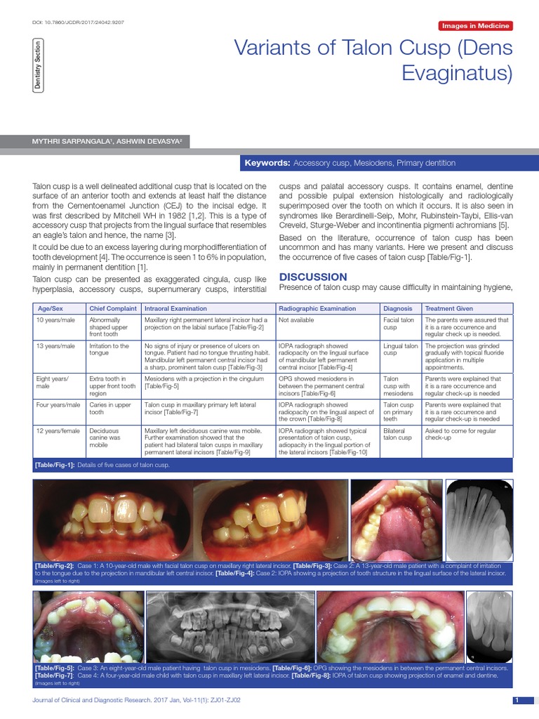 Variants of Talon Cusp in Dentistry | PDF | Animal Anatomy | Tooth