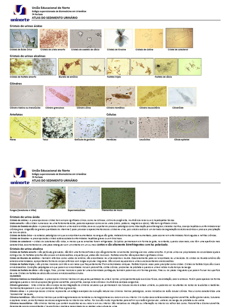 Atlas para Urinalise | PDF | Cristal | Especialidades médicas