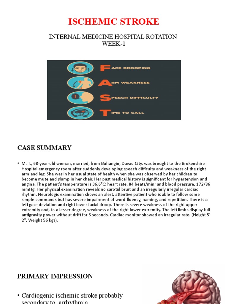 A Case Study of a 68-Year-Old Woman Presenting with Ischemic Stroke ...