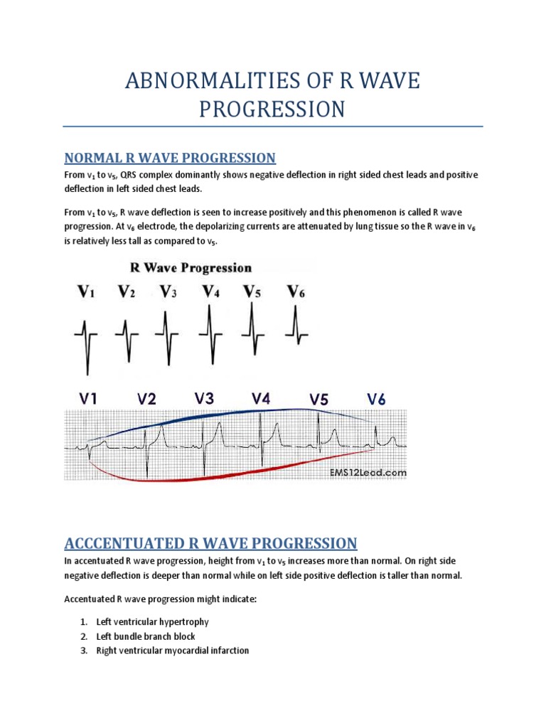 08 - Abnormalities of R Wave Progression | PDF | Physiology | Internal ...