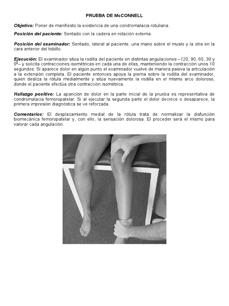 PRUEBA DE McCONNELL | PDF