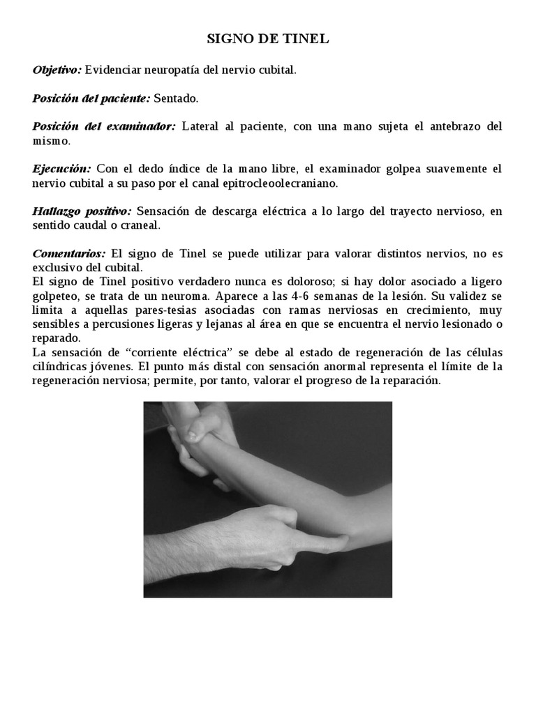 Signo de Tinel | PDF