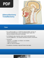 Adenoidectomy and Tonsillectomy 2 | PDF | Bleeding | Vertebral Column