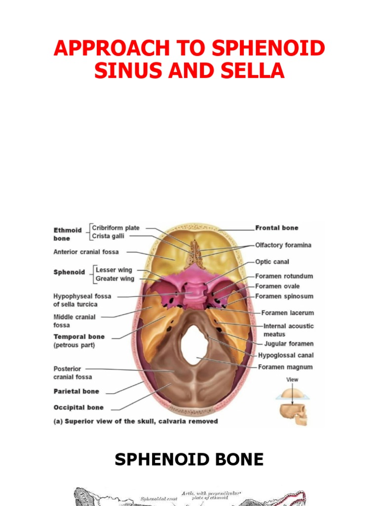 Approach To Sphenoid Sinus and Sella | PDF | Human Anatomy | Human Head ...