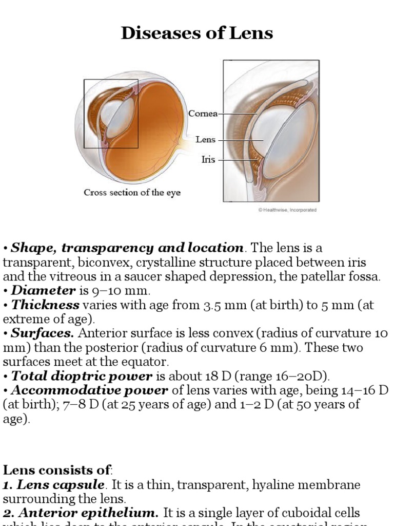 Diseases of Lens | PDF | Cataract | Glaucoma