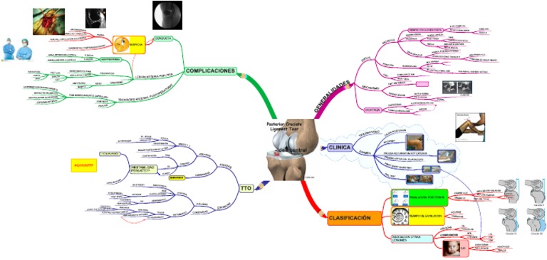 Mapa Mental de Lesion de LCP | PDF