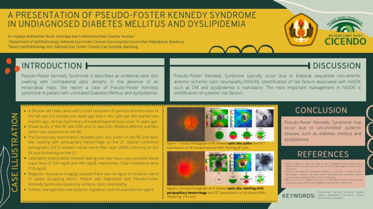 A Presentation of Pseudo-Foster Kennedy Syndrome in Undiagnosed ...