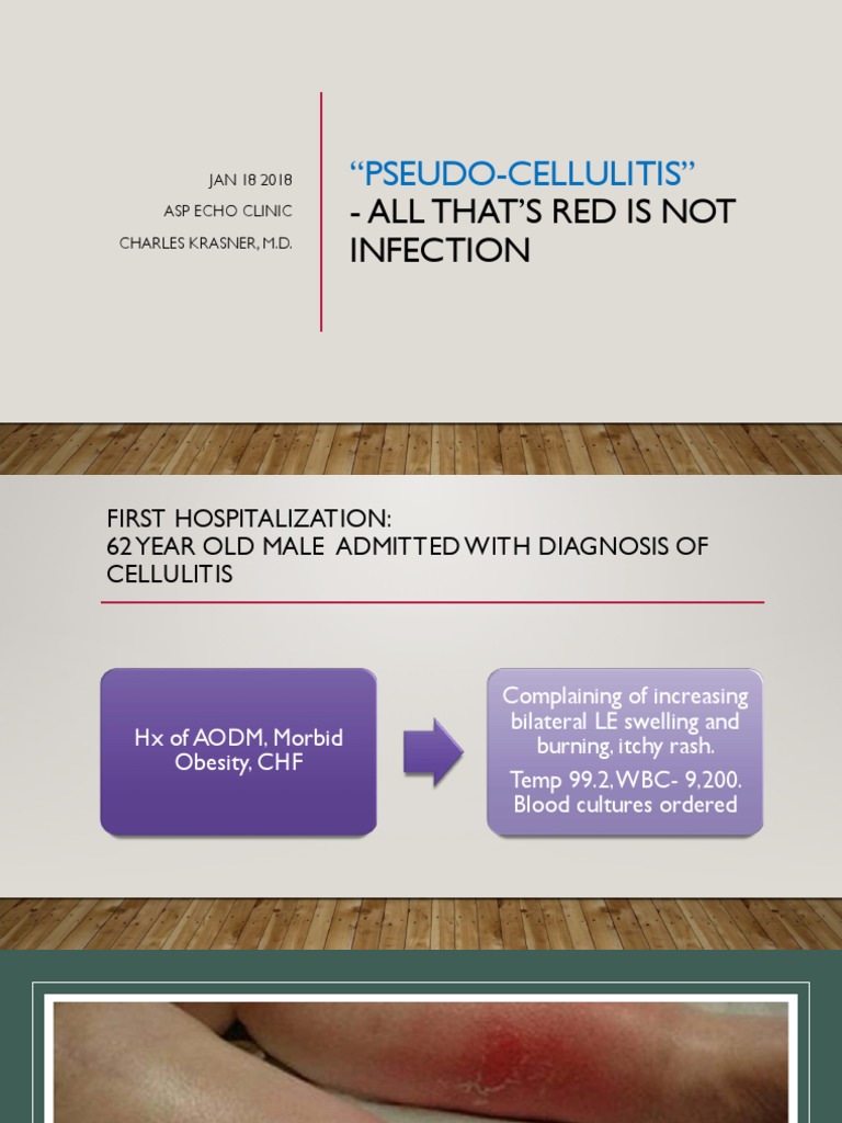 Cellulitis Talk Jan 2018 | PDF | Edema | Dermatitis