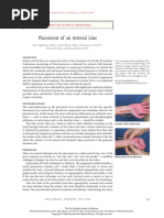 Arterial Line Arterial Line | PDF | Catheter | Intravenous Therapy