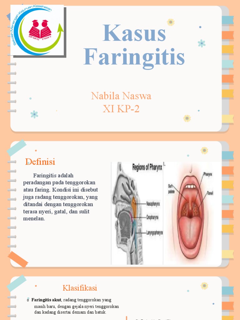 Faringitis | PDF