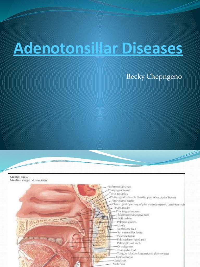 Adenotonsillar Diseases: Becky Chepngeno | PDF | Immunology | Epidemiology