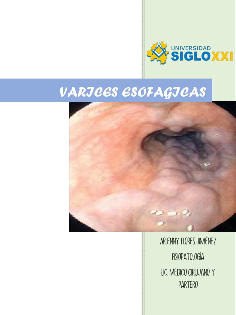 Varices Esofagicas | PDF | Cirrosis | Especialidades Medicas