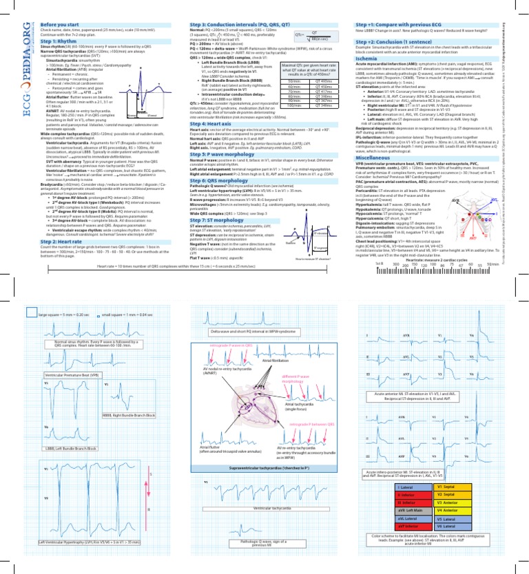 ECGpedia Reference Chart | Electrocardiography | Cardiac Electrophysiology