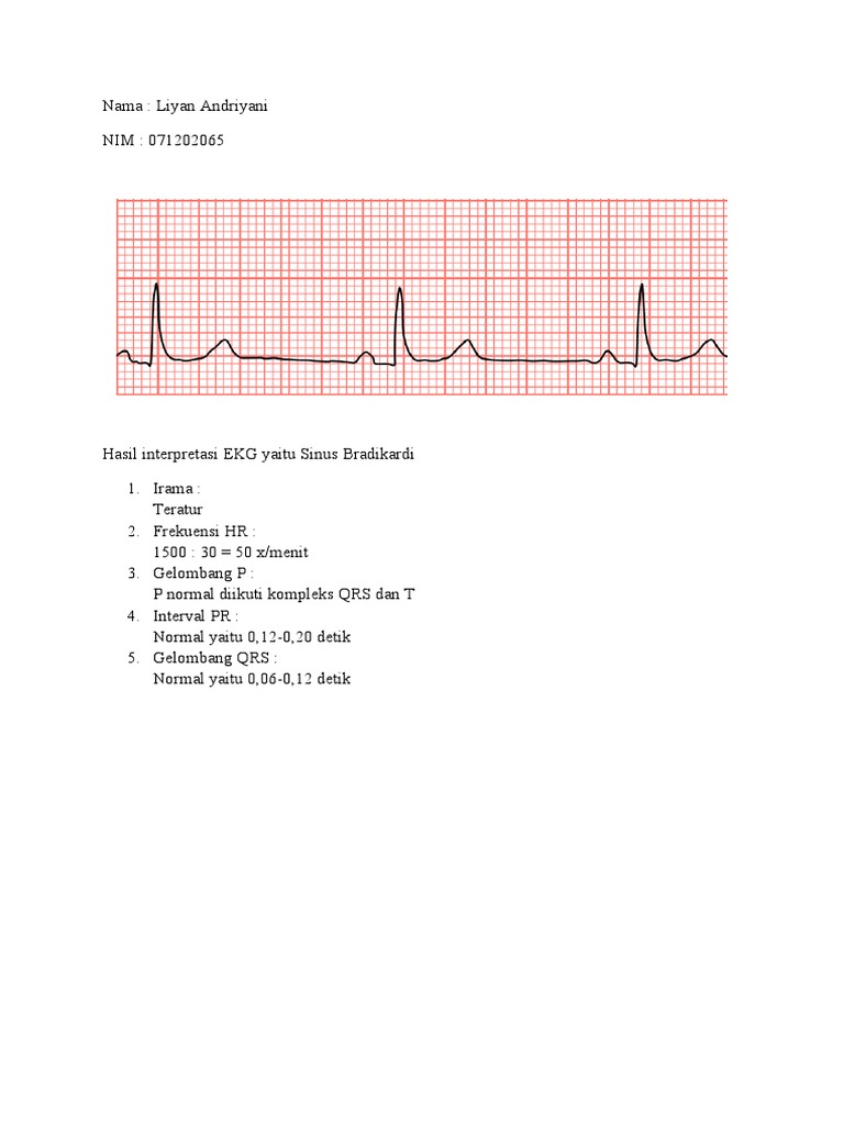 File EKG Skill Lab Liyan Andriyani Kelompok 7 Ners | PDF