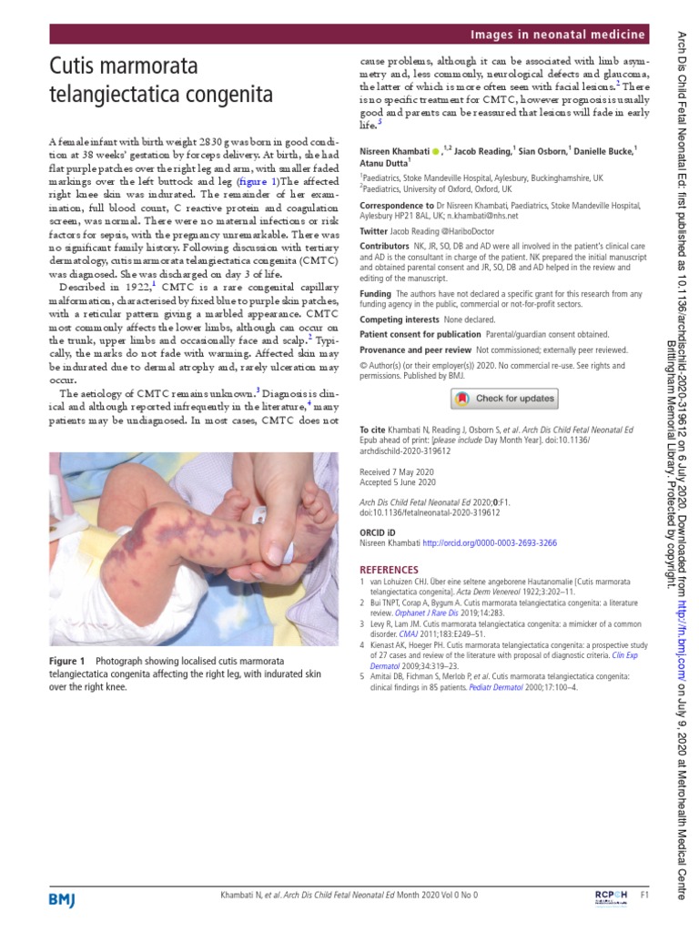 Cutis Marmorata Telangiectatica Congenita: Images in Neonatal Medicine ...