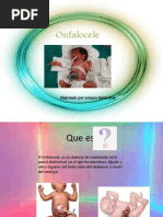 Onfalocele | PDF | Abdomen | Hospital