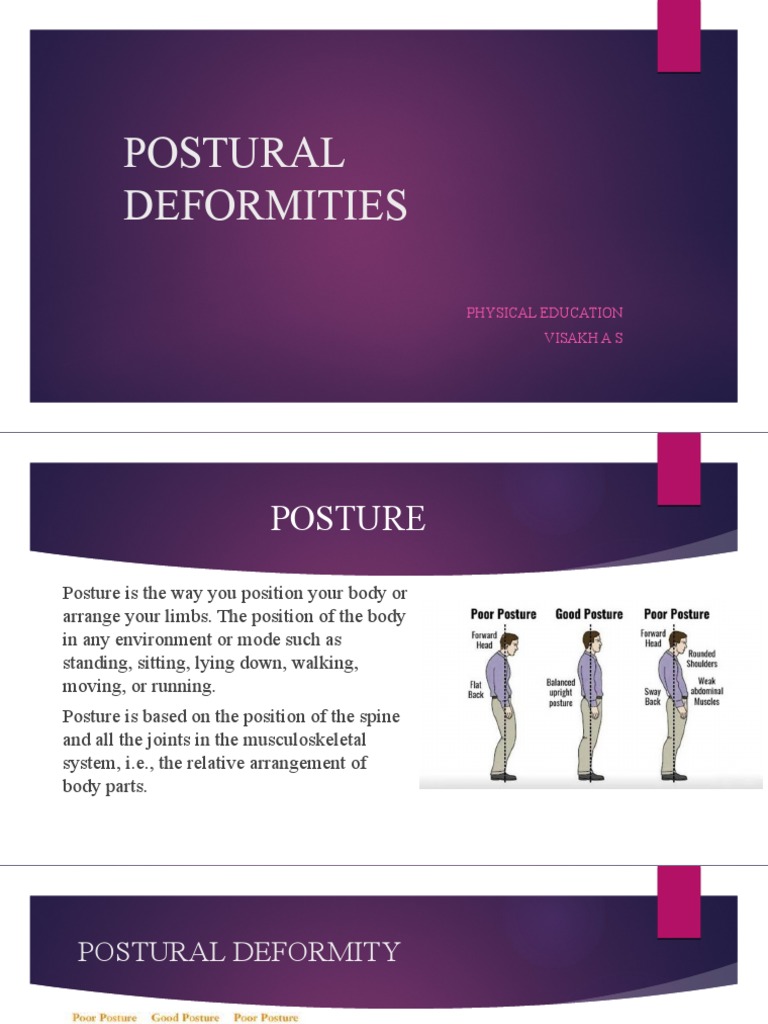 Major Postural Deformities and Corrective Exercises | PDF