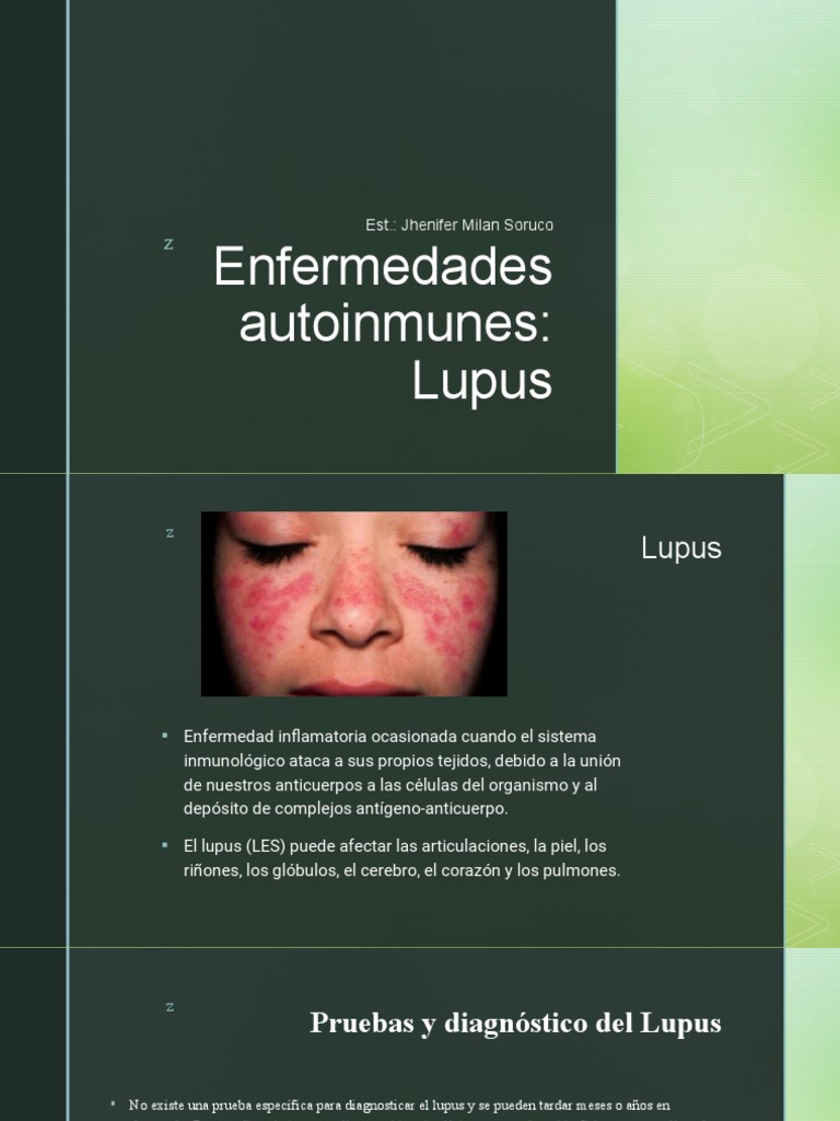 Presentación Lupus | PDF | Enfermedad autoinmune | Especialidades Medicas