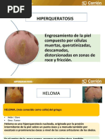 Hiperqueratosis y Helomas: Tipos y Tratamiento | PDF | Especialidades ...