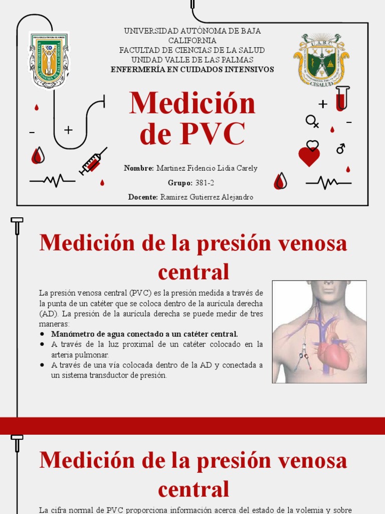 Medición de PVC - Martinez Fidencio | PDF | Vena | Angiología