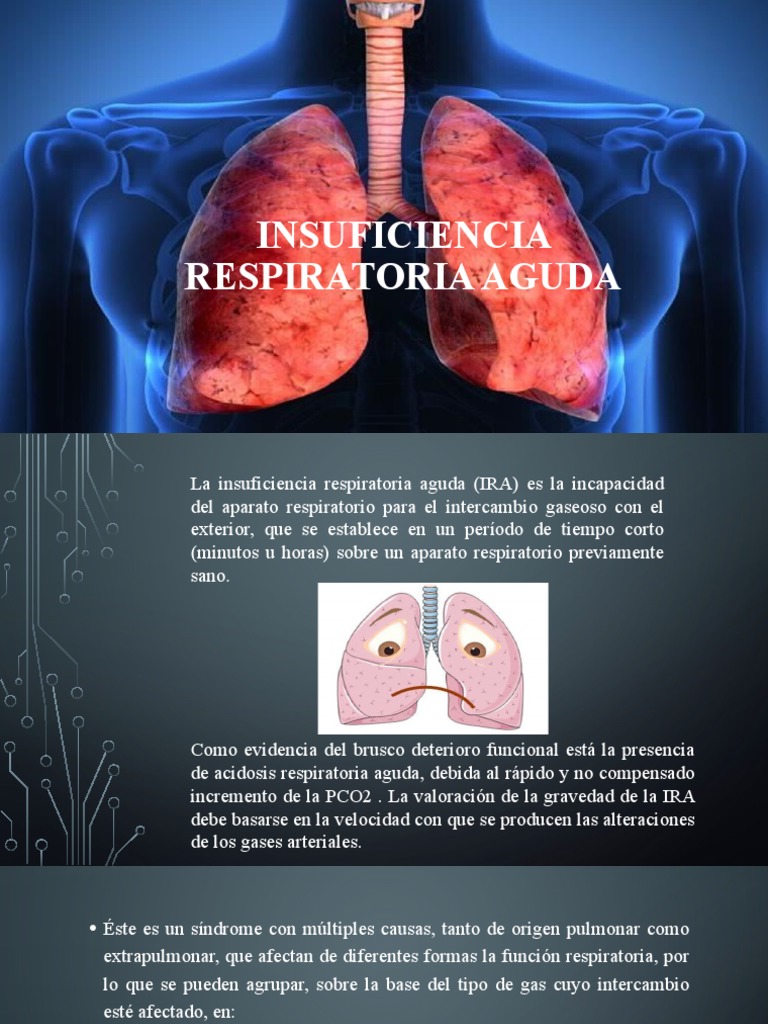 Insuficiencia Respiratoria Aguda | PDF | Especialidades Medicas ...