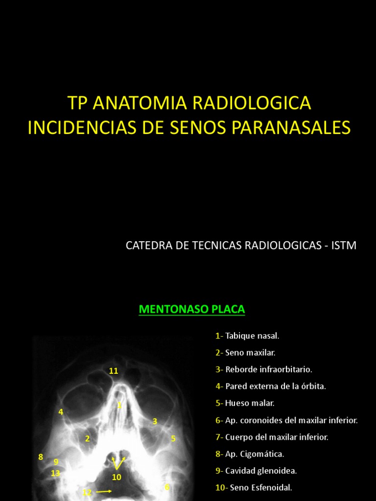 TP Anatomia Radiologica - Senos Paranasales | PDF