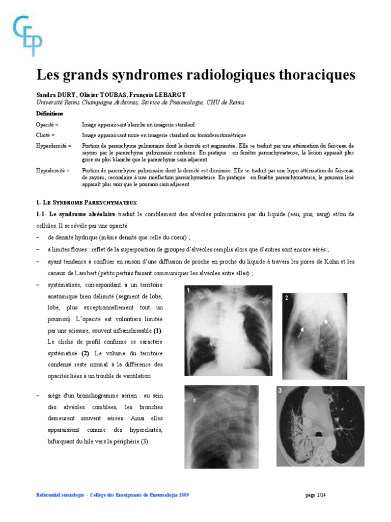 Grands syndromes radiologiques thoraciques | PDF | Poumon | Médecine ...