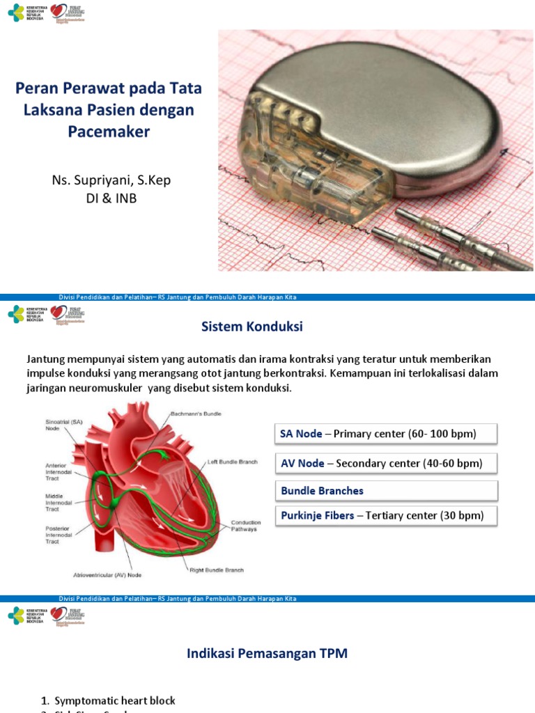 Indikasi dan Pemasangan Pacemaker Jantung | PDF