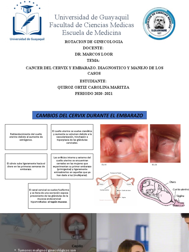 CA de Cervix en El Embarazo | PDF | Cáncer de cuello uterino | El embarazo