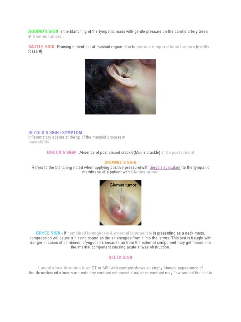 Eponymous Signs in Ent | PDF | Esophagus | Ear