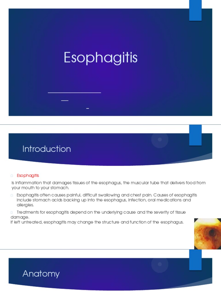 Esophagitis: Causes, Symptoms and Treatment | PDF | Esophagus ...
