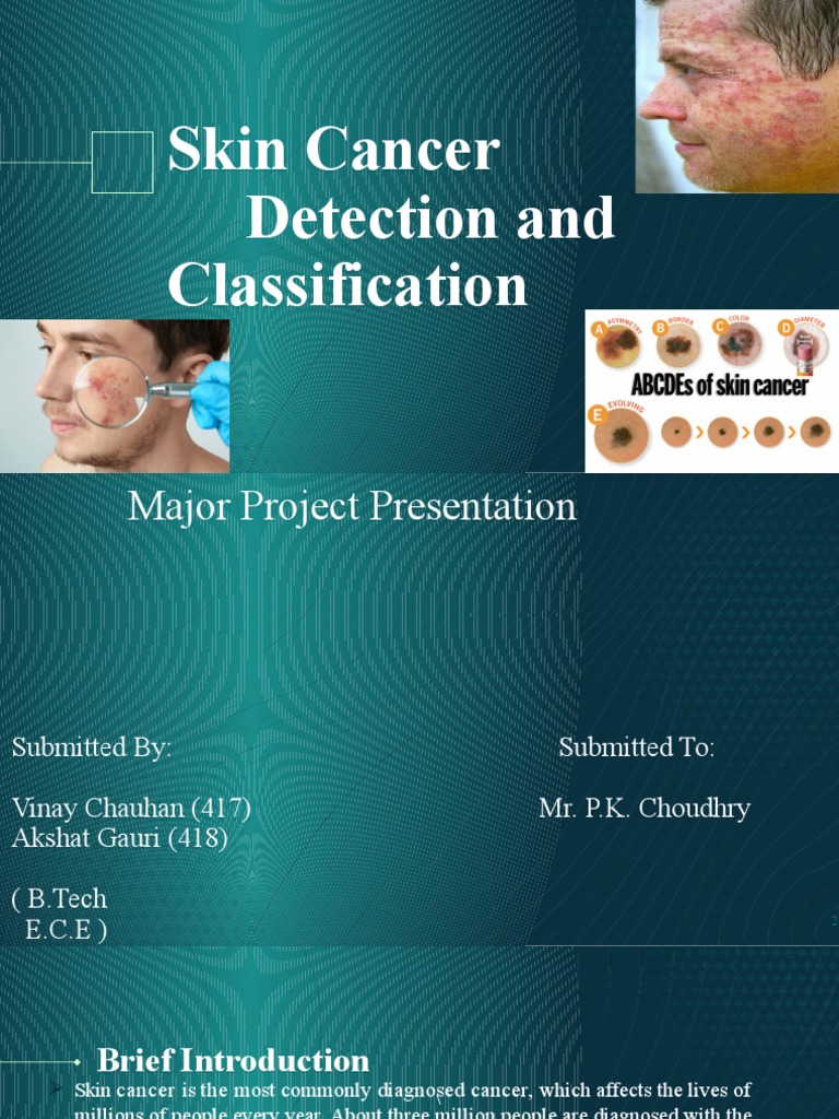 Skin Cancer | PDF | Skin Cancer | Image Segmentation