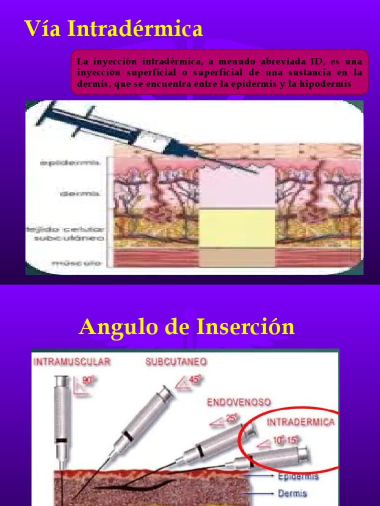 Vía Intradérmica | PDF