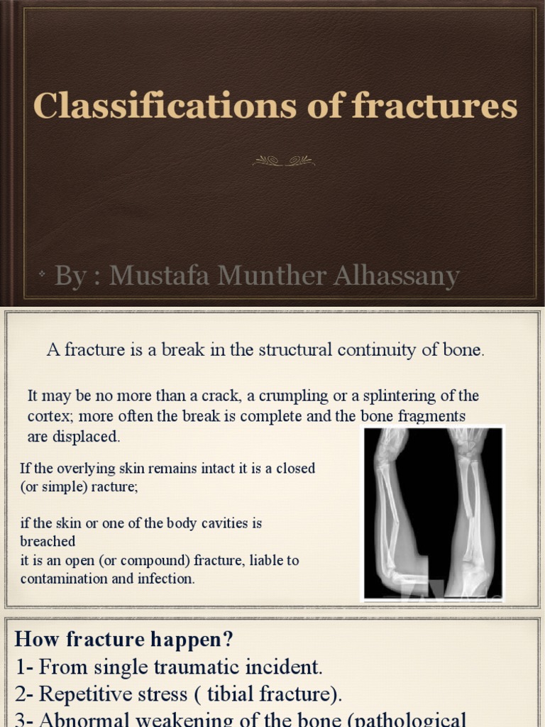 1 Classifications of Fractures | PDF | Musculoskeletal System ...