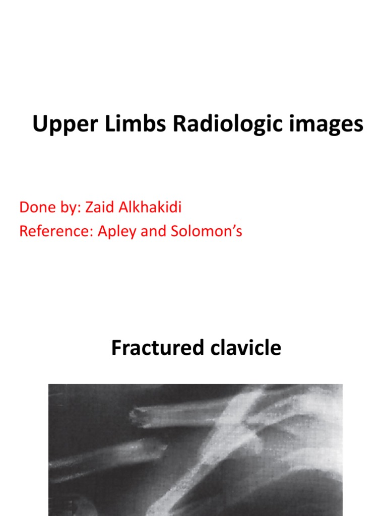 4# Upper Limb Injuries | PDF | Joints | Skeletal System