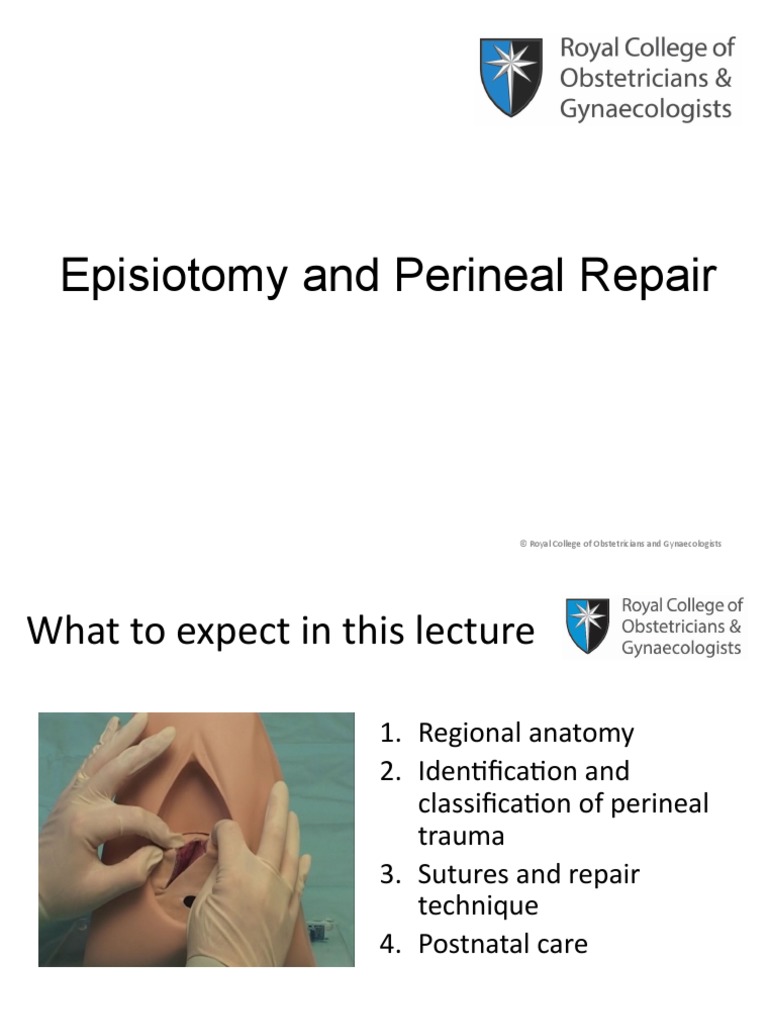 Episiotomy and Perineal Repair: © Royal College of Obstetricians and ...
