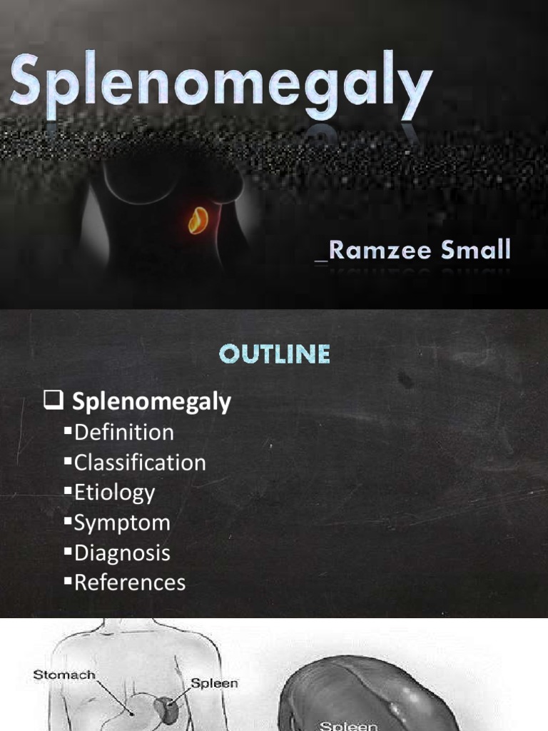 Splenomegaly 180319023541 | PDF | Spleen | Anatomy