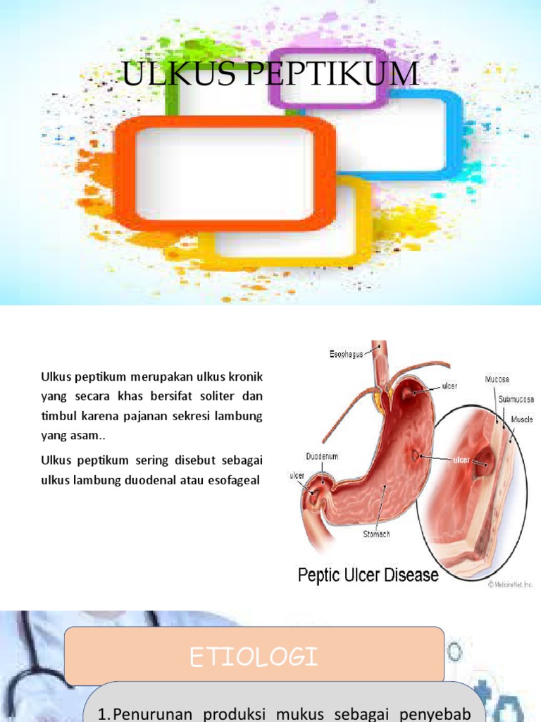 Ulkus Peptikum | PDF