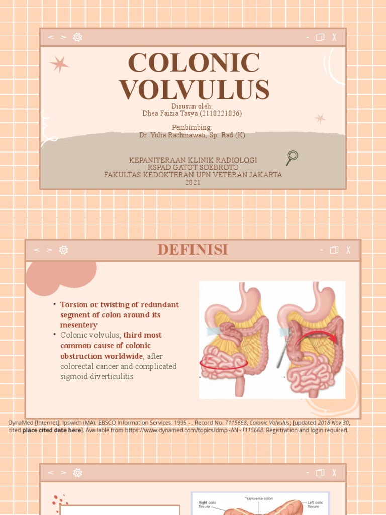Colonic Volvulus Radiology | PDF