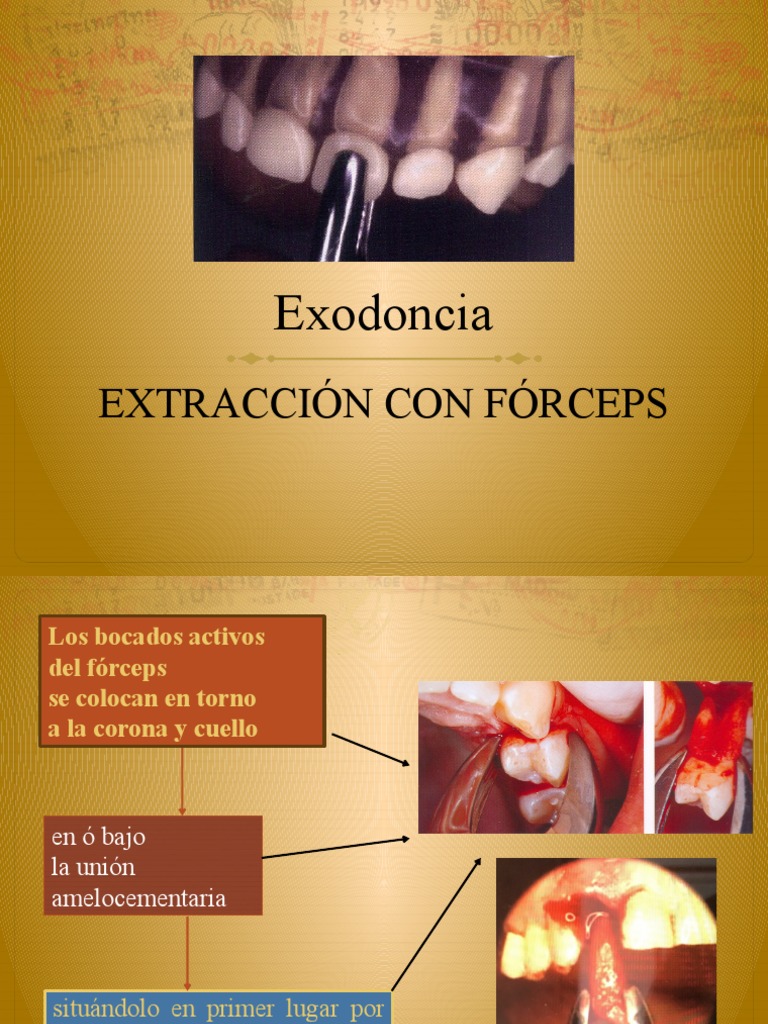Exodoncia 2a. Parte Forceps | PDF | Ciencias de la Salud ...