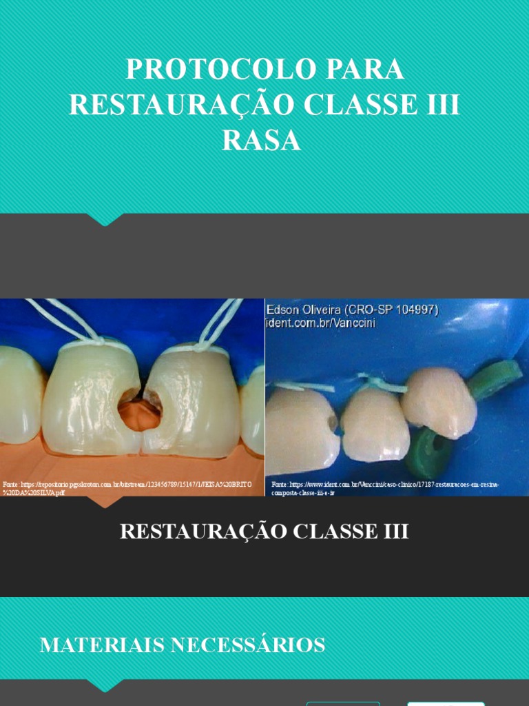 Protocolo para Restauração Classe III Rasa | PDF | Materiais