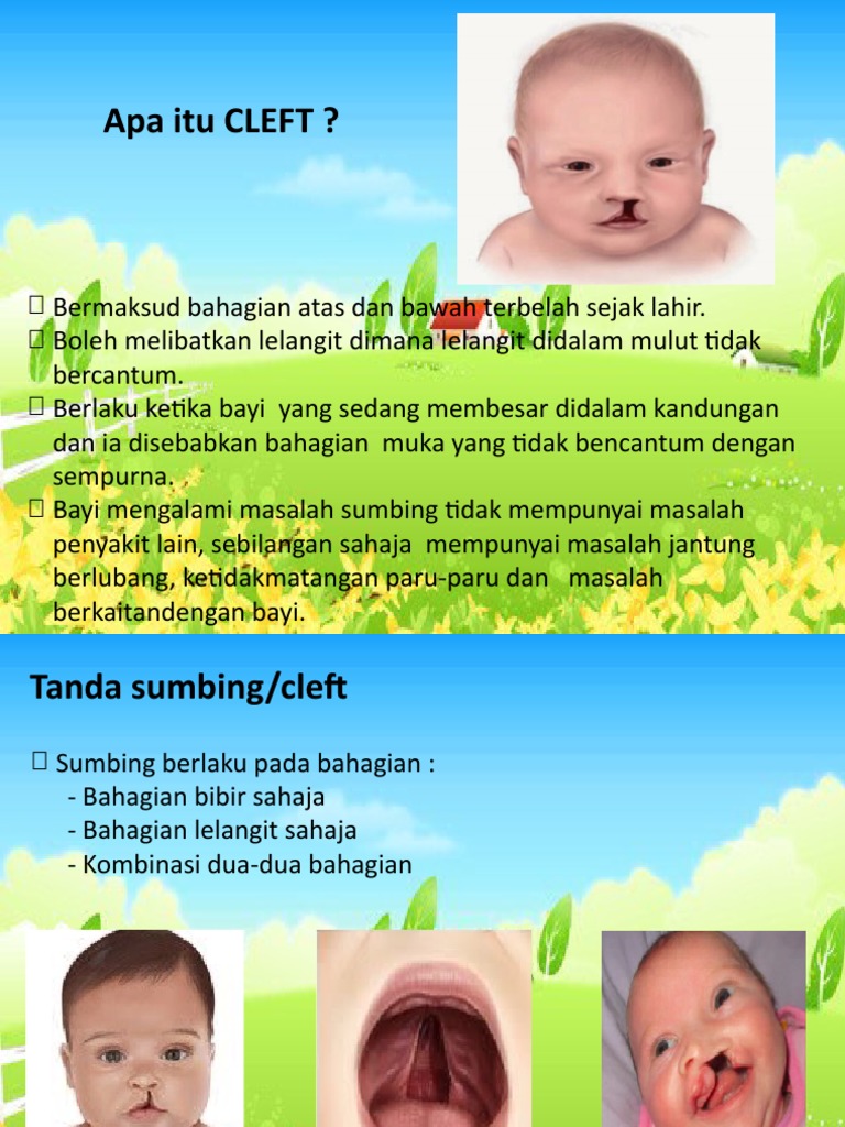 Cleft | PDF | Kesehatan Holistik | Sains & Matematika