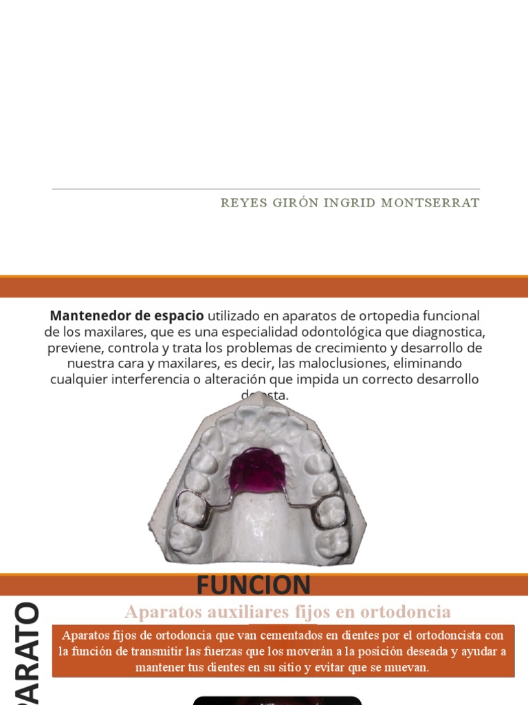 Botón de Nance | PDF | Ortodoncia | Ciencias de la Salud