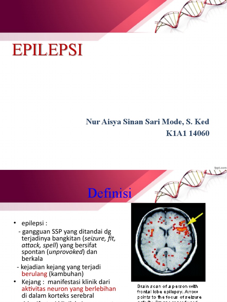 PPT Epilepsi | PDF