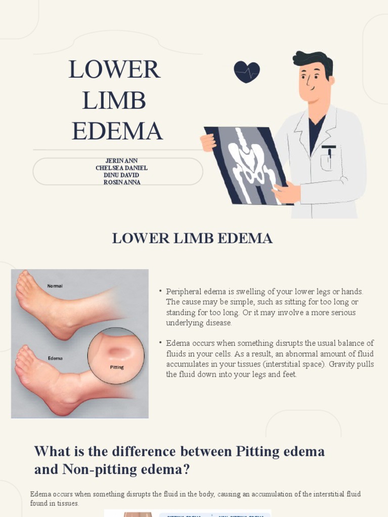 Lower Limb Edema: Jerin Ann Chelsea Daniel Dinu David Rosin Anna | PDF ...
